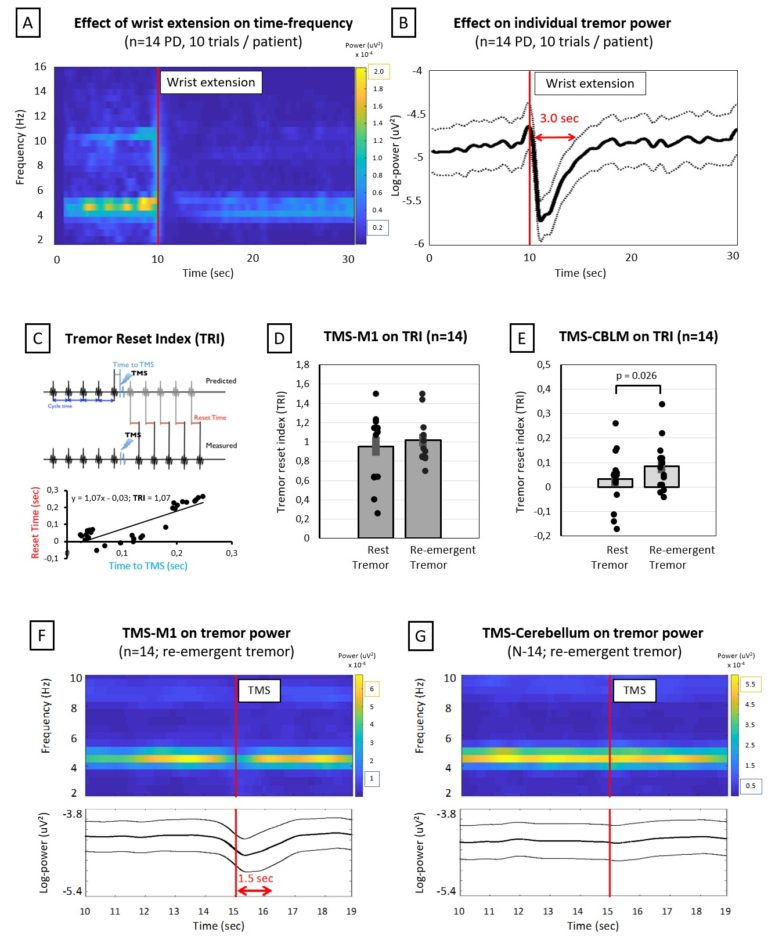 Systems Neurology | Tremor | Systems Neurology